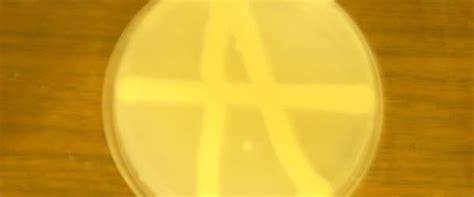 Satellite Colonies Problem With Ampicillin Selection