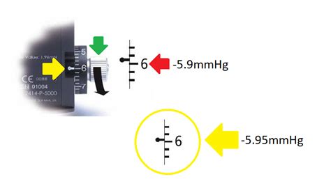 How To Check The Calibration Of A Goldmann Type Applanation Tonometer