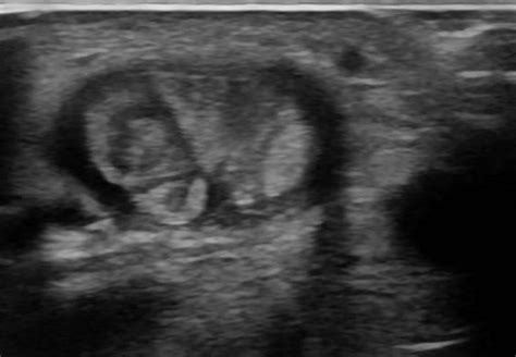 Musculoskeletal Joints And Tendons 63 Wrist And Carpus Case 631