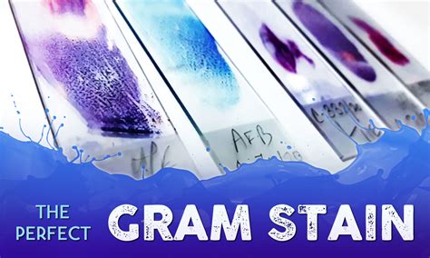 Gram Stain Procedure In Microbiology New Spin On Gram Stain Bacteria