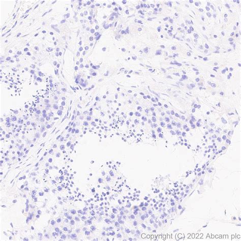 Anti St14 Antibody Epr26785 94 Ab307599 Abcam