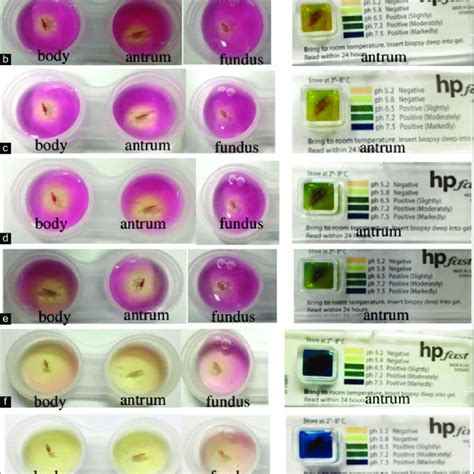 Gastric Biopsy Samples Of The Body Antrum And Fundus Were Analyzed By Download Scientific