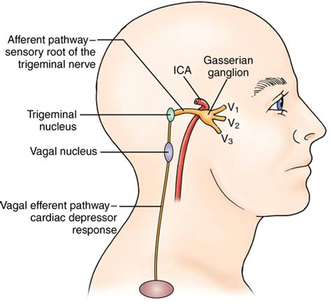Oculocardiac Reflex Clinical Gate
