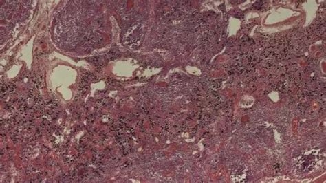 Take Look Human Body Cells Scientific Microscope Animation — Stock