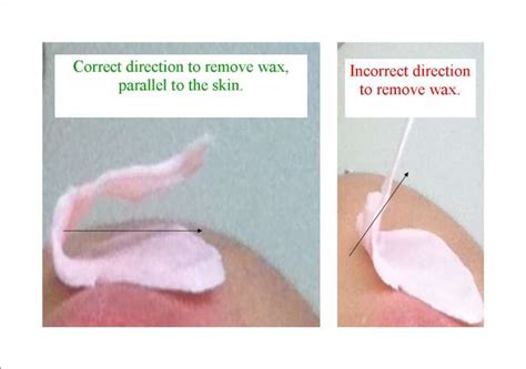 Waxing How To Wax Your Arm Hair Free Like A Pro Hubpages