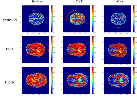 Figure 3 From Frequency Domain Decomposition Translation For Enhanced Medical Image Translation