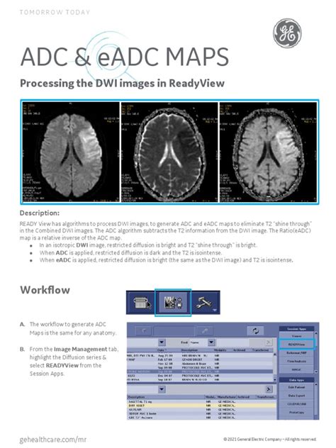Adc And Eadc Maps Processing The Dwi Images In Readyview Pdf Analog