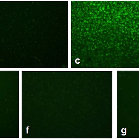 Detection Of Mitochondrial Membrane Potential Using Rhodamine 123 In Download Scientific