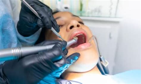 What Is A Detailed Procedure For Tooth Extraction Surgery The Wisdom