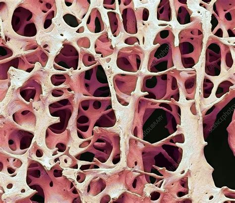 Spongy Bone Under Microscope