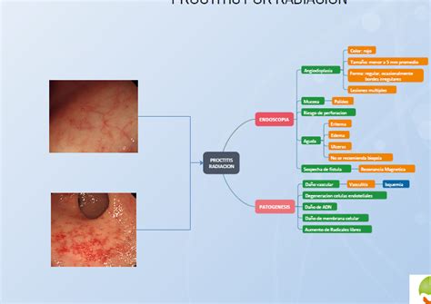 Proctitis Síntomas Causas Y Tratamiento