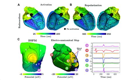 Activation And Repolarization Patterns During Normal Sinus Rhythm
