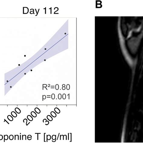 Pv Loop Analysis Of Diastolic Left Ventricular Function 56 And 112 Days Download Scientific