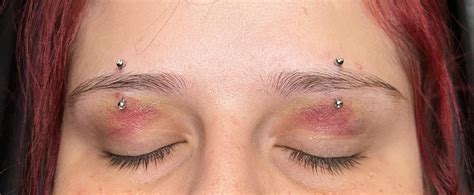 Day 4 Of Double Center Eyebrow Piercings 🤨😂 Rpiercing