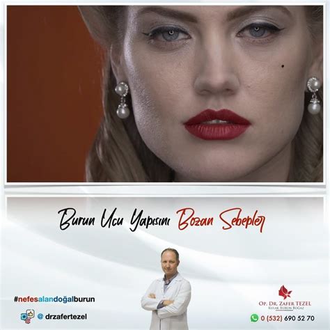 🔹burun Derisi Kalınlığı 🔹burun Derisi Altı Yumuşak Doku Fazlalığı 🔹travma 🔹burun Ucu