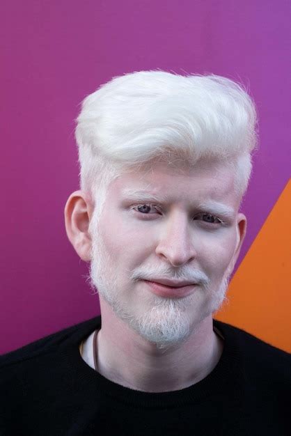 Retrato De Un Hombre Albino Mirando A La Cámara Foto Premium
