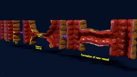 Angiogenesis 3d Model