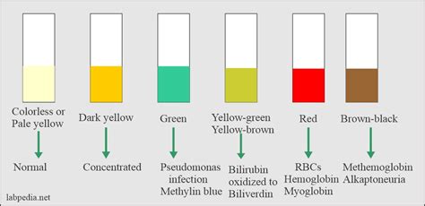 Urine Color Chart Urine Color Chart Whats Normal And When To See A Doctor Urine Color