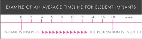 Dental Implants Eledent Dentist In Sutton Eledent Dentist In Sutton