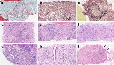 Examples Of Typical Well Agreed And Poorly Agreed Histological
