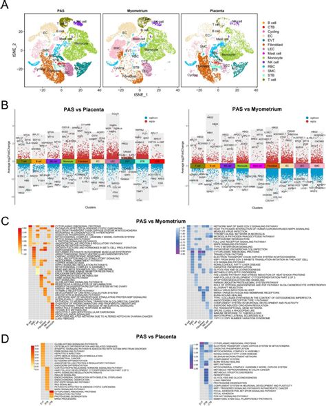 Single Cell And Spatial Transcriptomics Reveal Alterations In