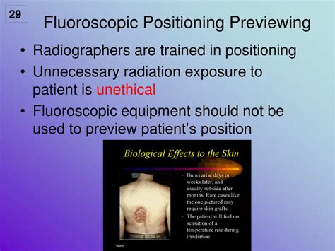 Ppt Introduction To Fluoroscopy And Radiation Safety Powerpoint