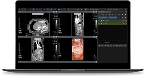 Aview Pseudonymization Server Medical Data De Identification
