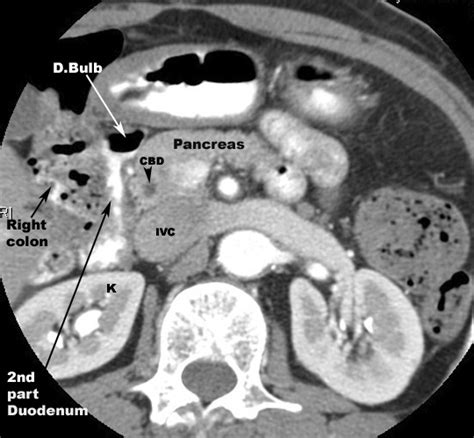 Duodenum Cat Dissection Cat Lab Guide