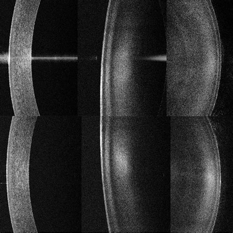 Hoct Biometry Module Biometry Module
