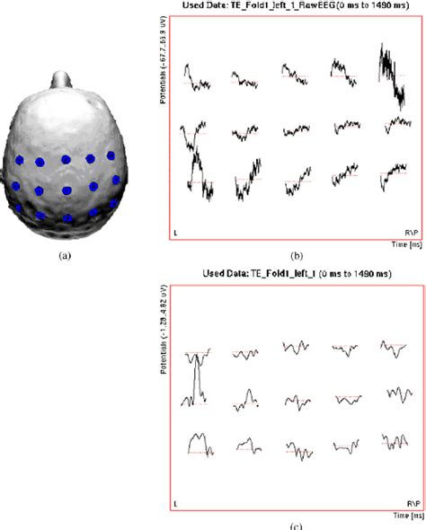 Scalp Recordings Before And After Surface Laplacian Filtering And Download Scientific Diagram