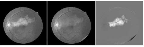 From Left To Right Original Image The Low Rank Component And The Download Scientific Diagram