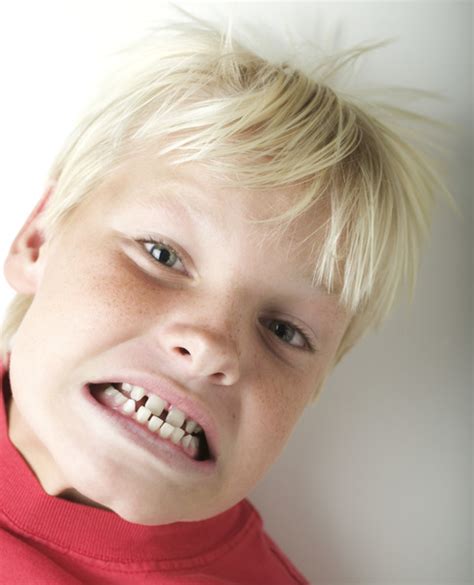 Boy Gritting His Teeth Free Photo Download Freeimages