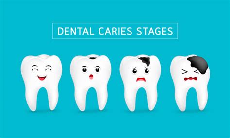 19900 Cavity Stock Illustrations Royalty Free Vector Graphics And Clip