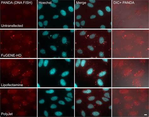 The Cytoplasmic Puncta Forming After Transient Transfection Are Download Scientific Diagram
