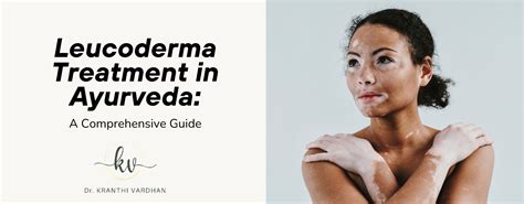 Leucoderma Treatment In Ayurveda A Comprehensive Guide