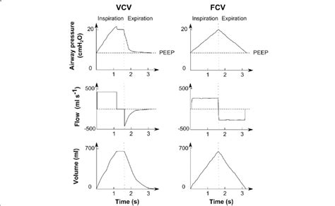 Comparison Of Flow Controlled Ventilation Fcv With Conventional