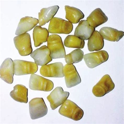 Partial Denture With Acetal Framework Clasps And Acrylic Saddles