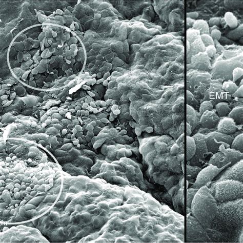 Morphology Of The Visceral Pleural Mesothelium A Scanning Electron
