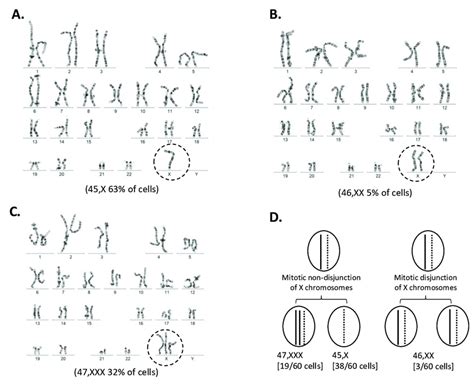 Genetic Testing For Chromosome Analysis At Charli Blamey Blog