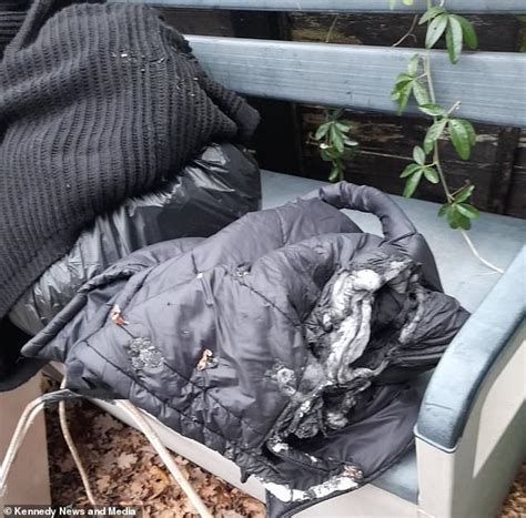 Mother Says She Is Lucky To Be Alive After Rechargeable Vape Battery Exploded In Her Puffer