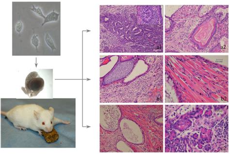Histology Of Teratoma Induced By Esc Injection Teratoma Was Induced By
