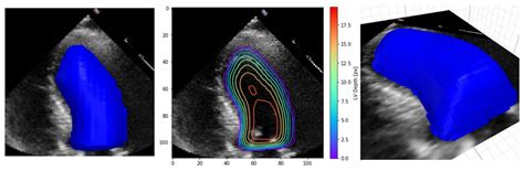 Explainability Of Deep Learning Models In Medical Video Analysis A Survey Peerj
