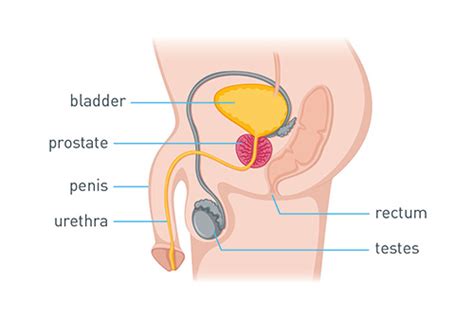 What Is Prostate Cancer Epworth Healthcare