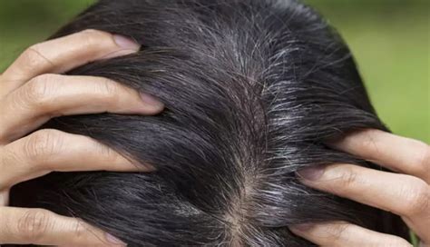 5 Natural Ways You Can Darken Grey Hair At Home