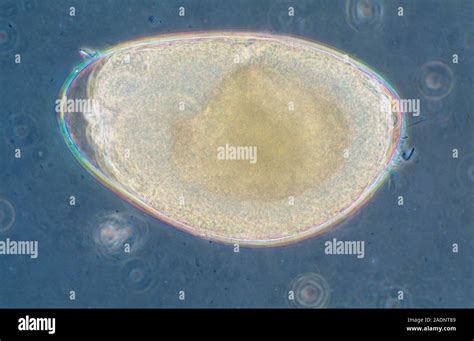 Black Fly Egg Light Micrograph This Small Fly Simulium Damnosum