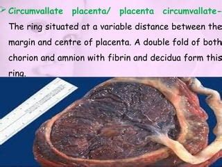 501340725 Unit 2 Fertilization Impantation Development Of Placenta And