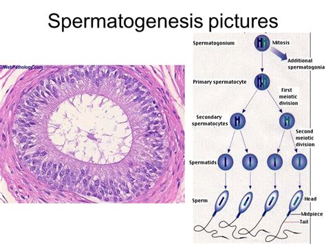 Spermatogenesis Slide Labeled