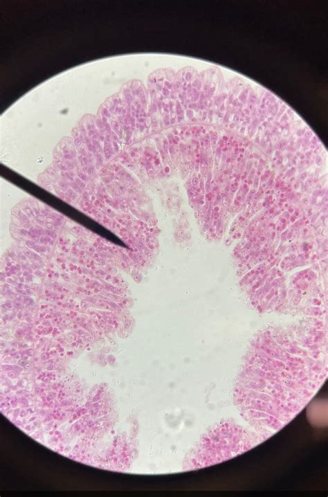 Hydra Cross Section Diagram Quizlet