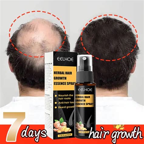 7 Days Fast Hair Growth Hair Grower For Men Original Minoxidil Regrow