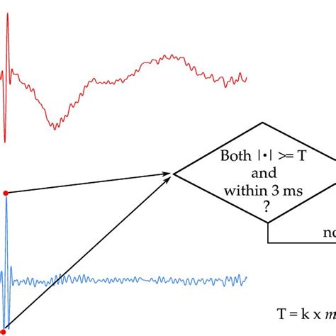 the pacemaker spike detection algorithm proposed by herleikson [31